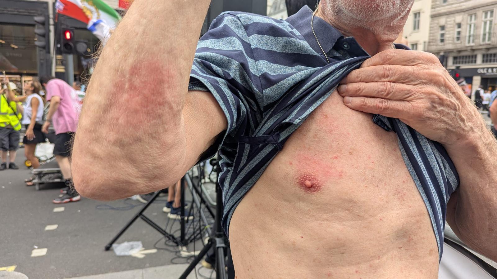 Teenager arrested after Jewish men injured in bottle attack at London ...